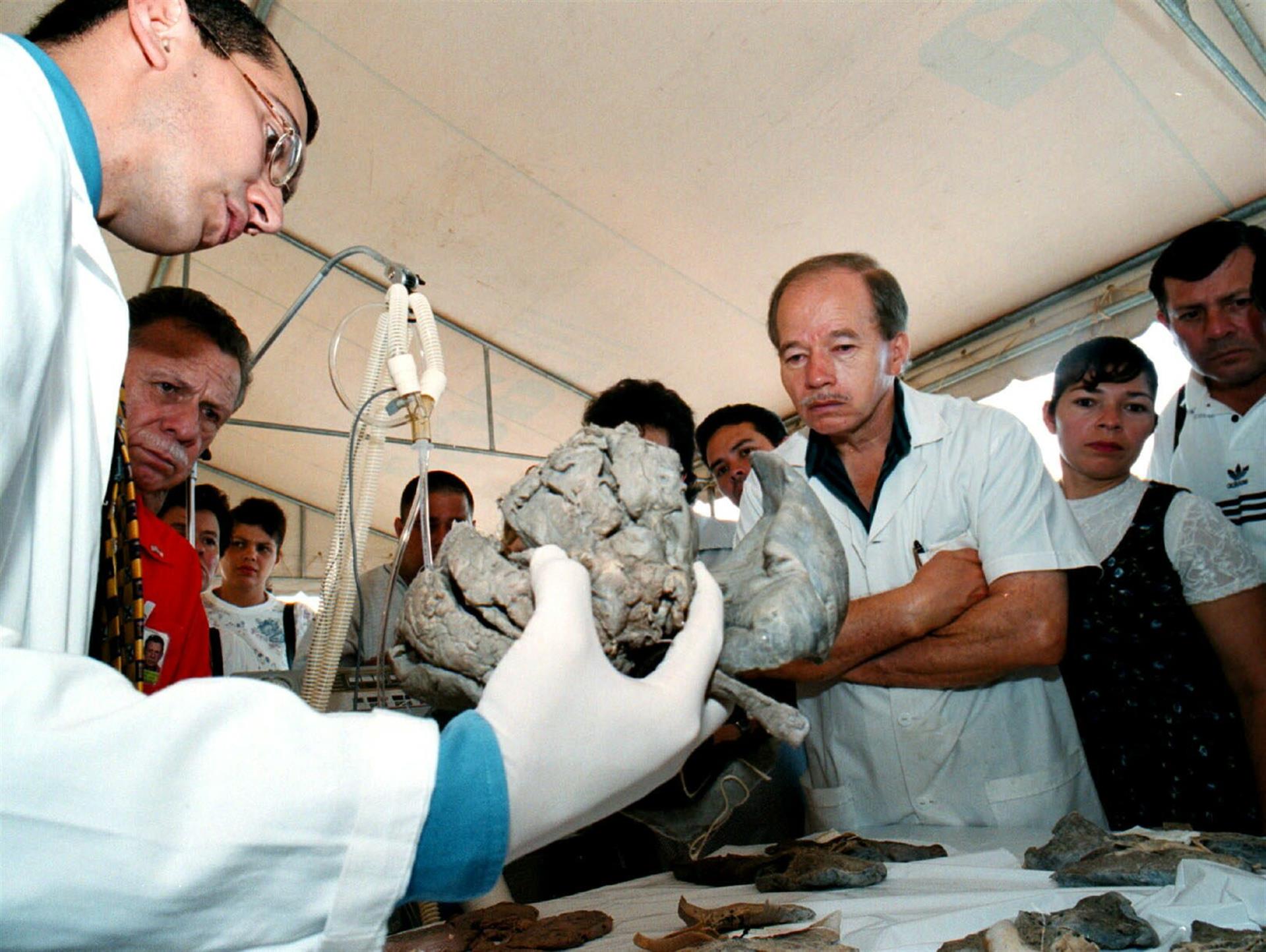 Cáncer de pulmón, la neoplasia que cobra anualmente la vida de más de 7 ...